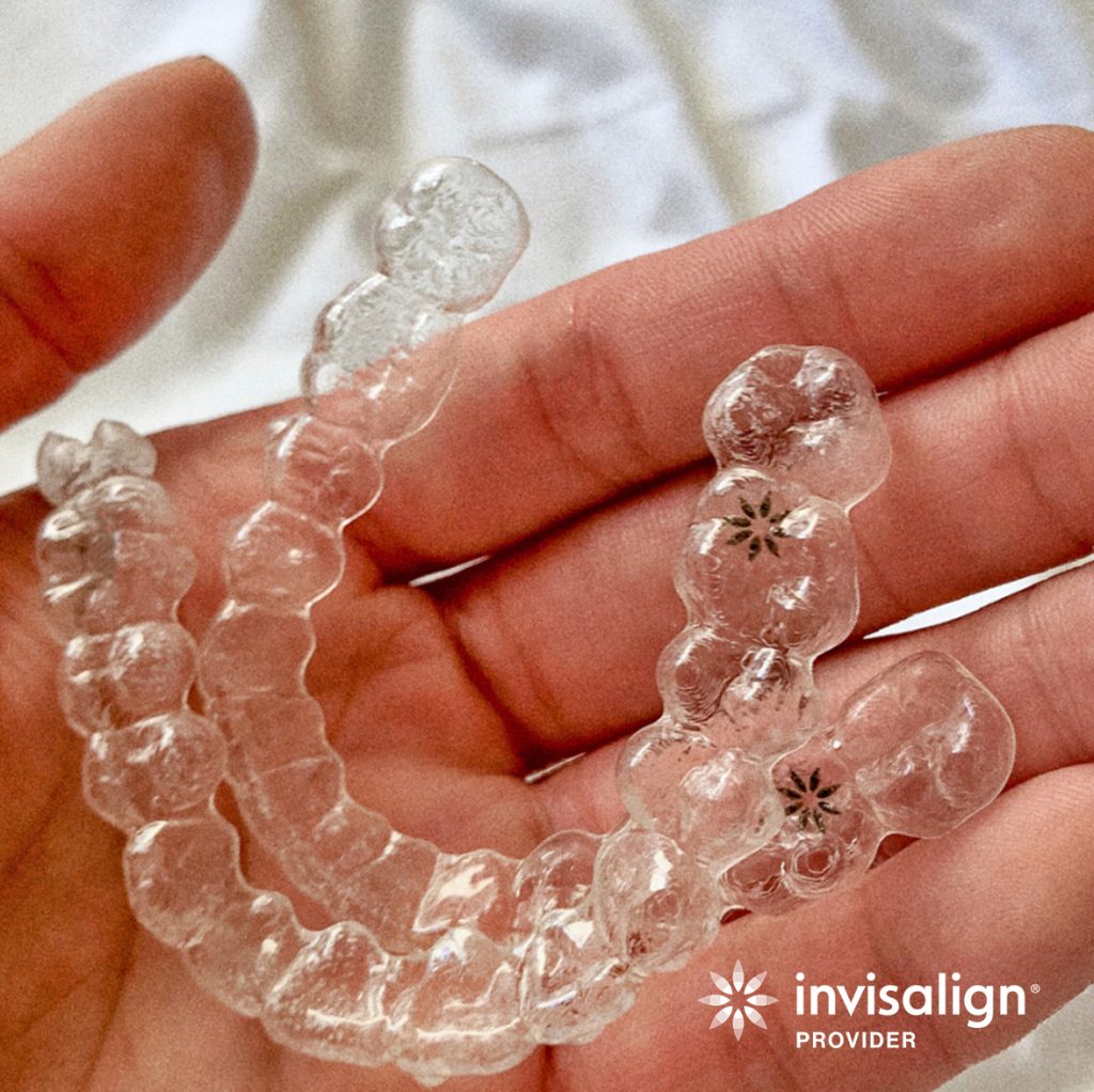 My Invisalign Aligners are Cutting My Gums. What Can I Do?